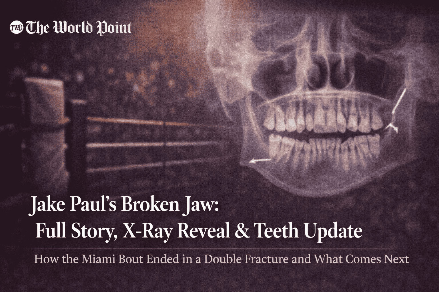 Jake Paul Broken Jaw – Full Story, X-Ray Reveal, Teeth - The World Point